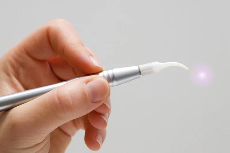Láser Terapéutico en Odontología: Innovación para Tratamientos Menos ...